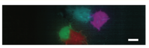Beyond colour vision – spotting cancer when it hides between the red ...