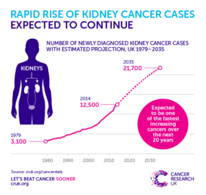 Kidney cancer rates are increasing, so what’s fuelling the surge ...