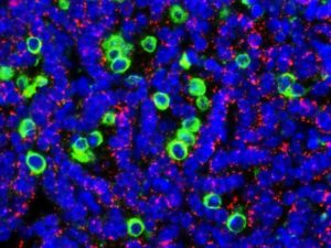 Tackling ‘undruggable’ genes in lung and pancreatic cancers is this ...