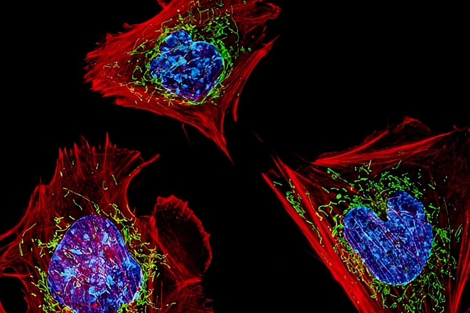 Latest News - Cancer Research UK - Cancer News