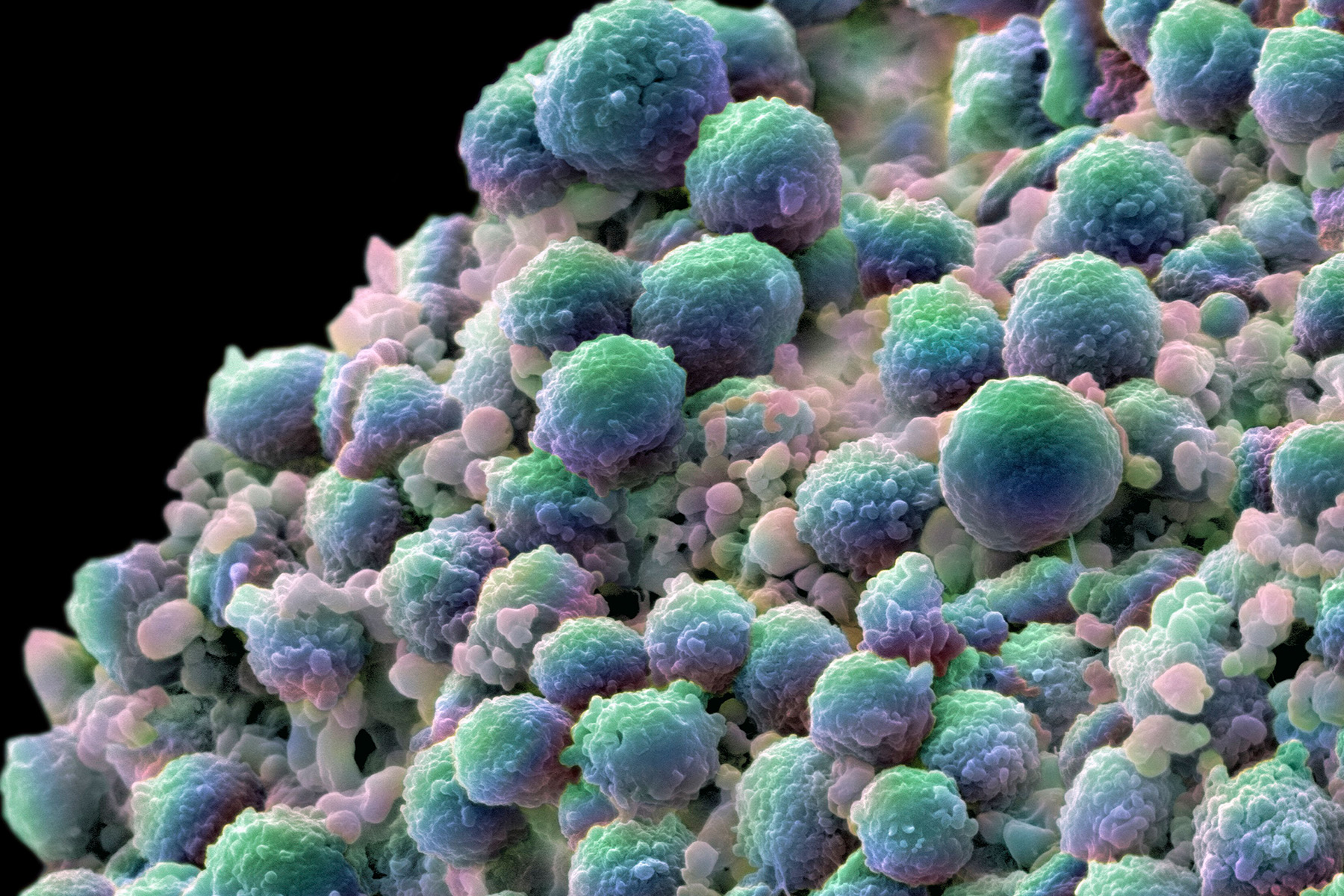 Thousands more men in England offered abiraterone, one of our prostate ...