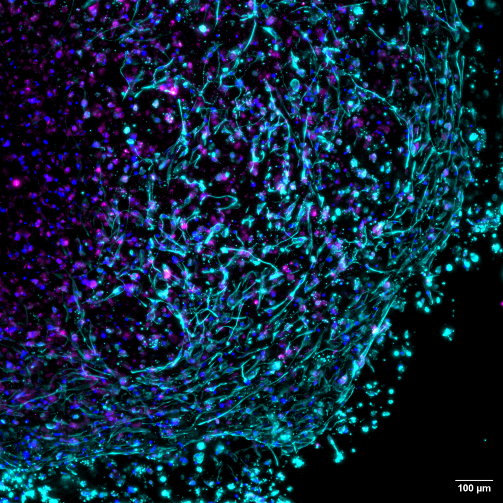 Latest winner in our Research is Beautiful campaign - Cancer Research ...