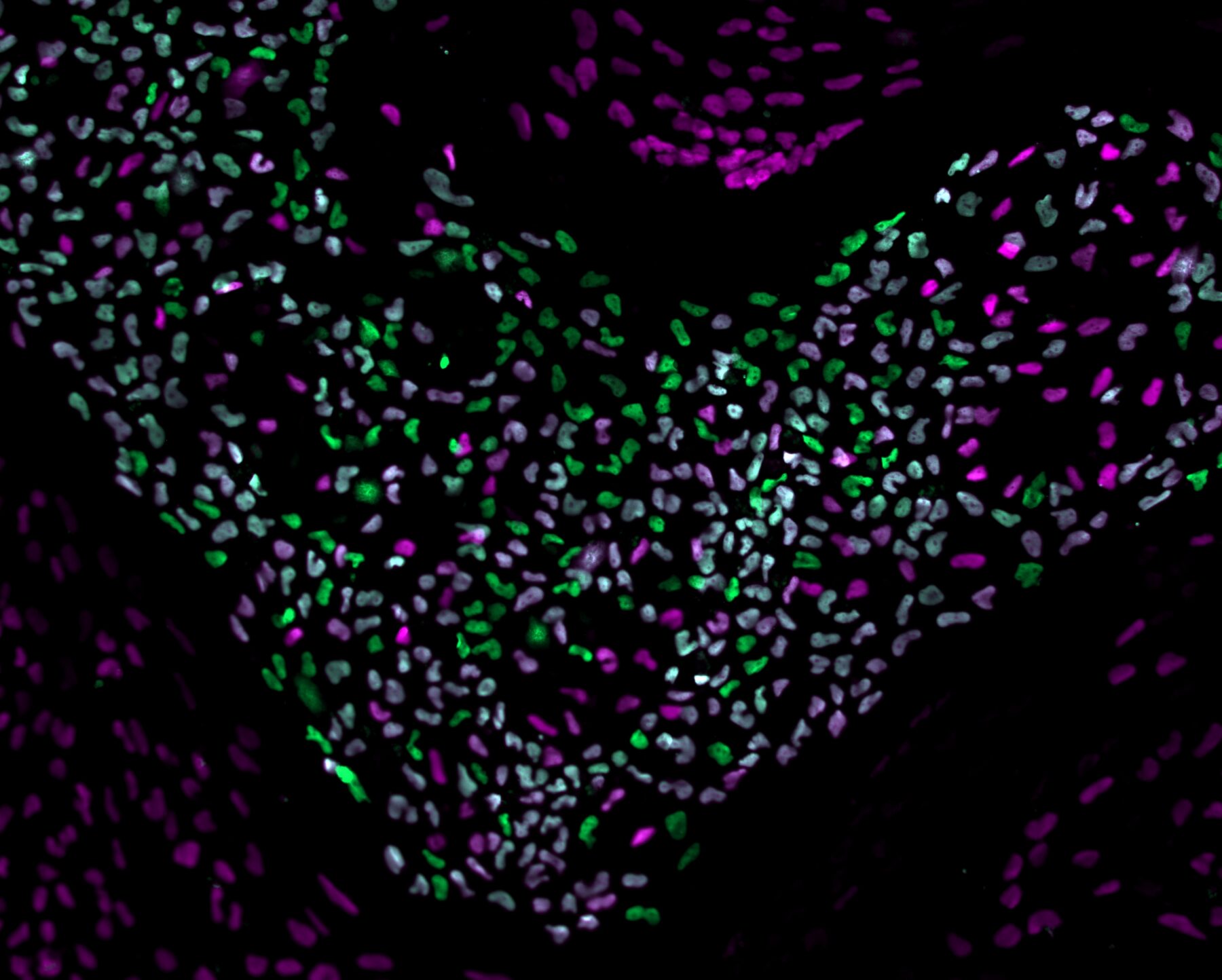 Latest winner in our Research is Beautiful campaign - Cancer Research ...